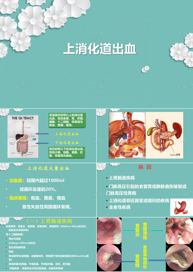 消化道出血PPT模板下载 编号lzpyjpwl 熊猫办公