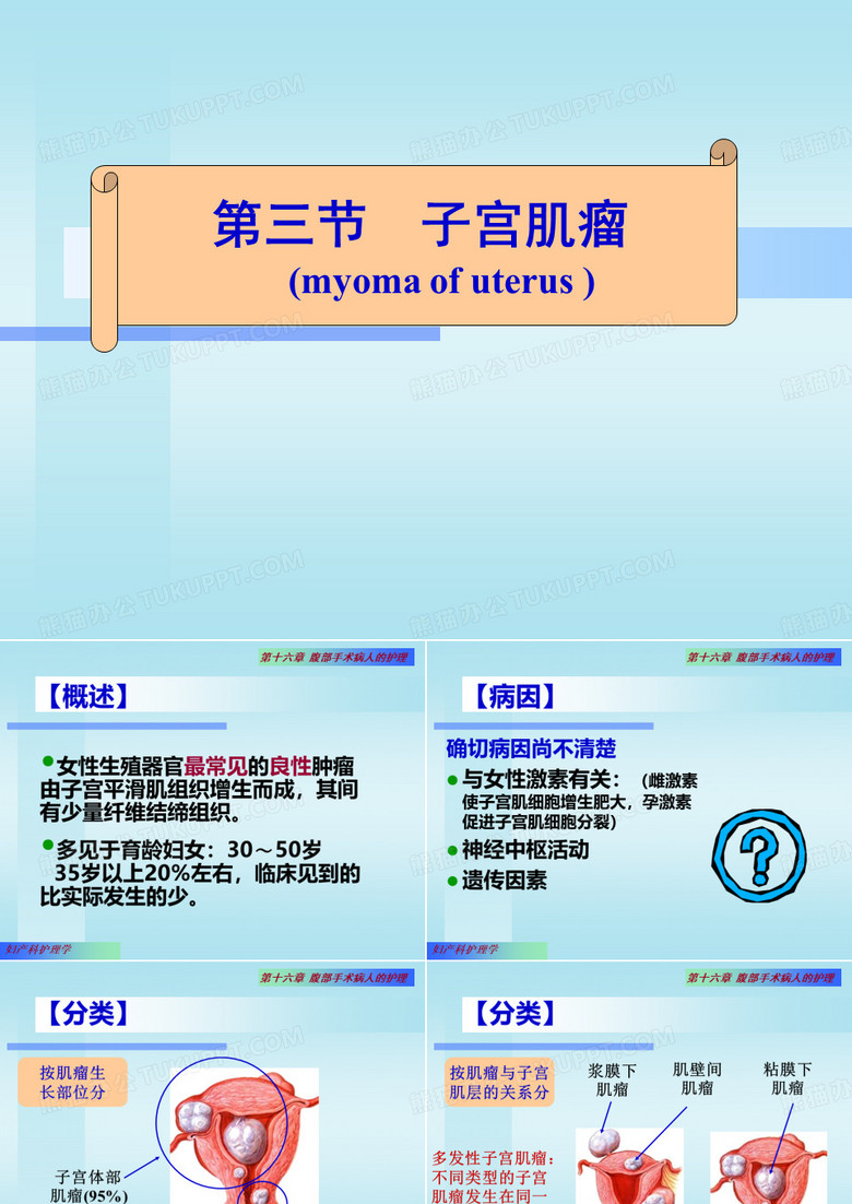 子宫肌瘤PPT模板下载 编号qbggxzbo 熊猫办公