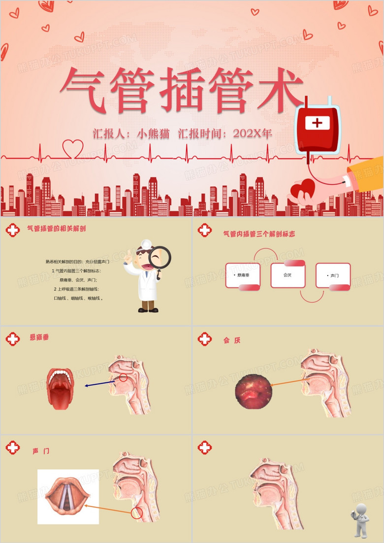 气管插管术气管插管的护理PPT模板下载 熊猫办公