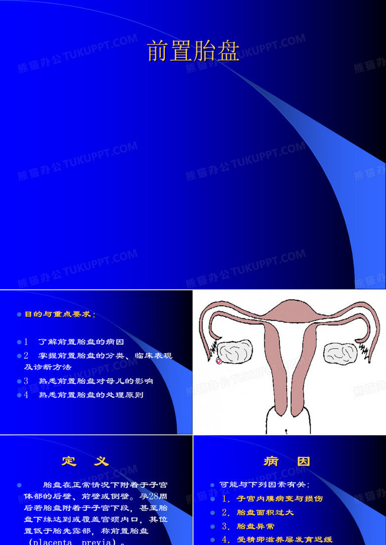 前置胎盘PPT模板下载 编号lxwegzvn 熊猫办公