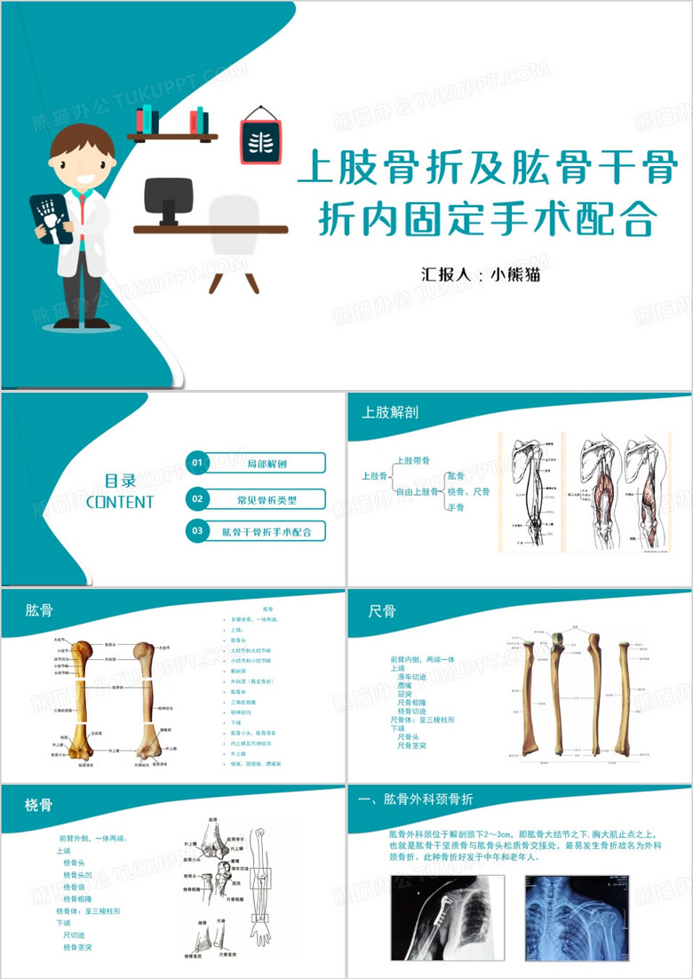 上肢骨折及肱骨干骨折内固定手术配合PPT模板下载 熊猫办公