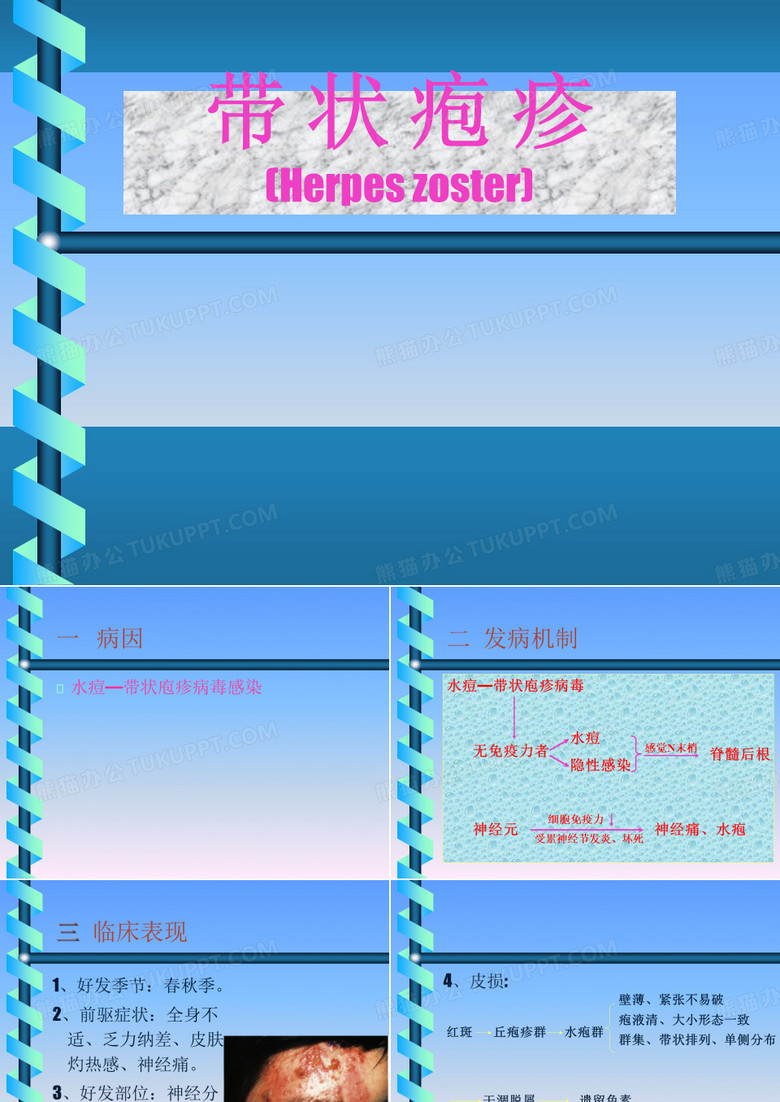 带状疱疹PPT模板下载 编号ljxkjnze 熊猫办公
