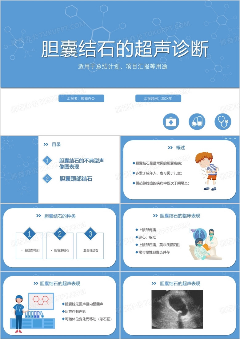 简约风胆囊结石的超声诊断PPT模板下载 熊猫办公