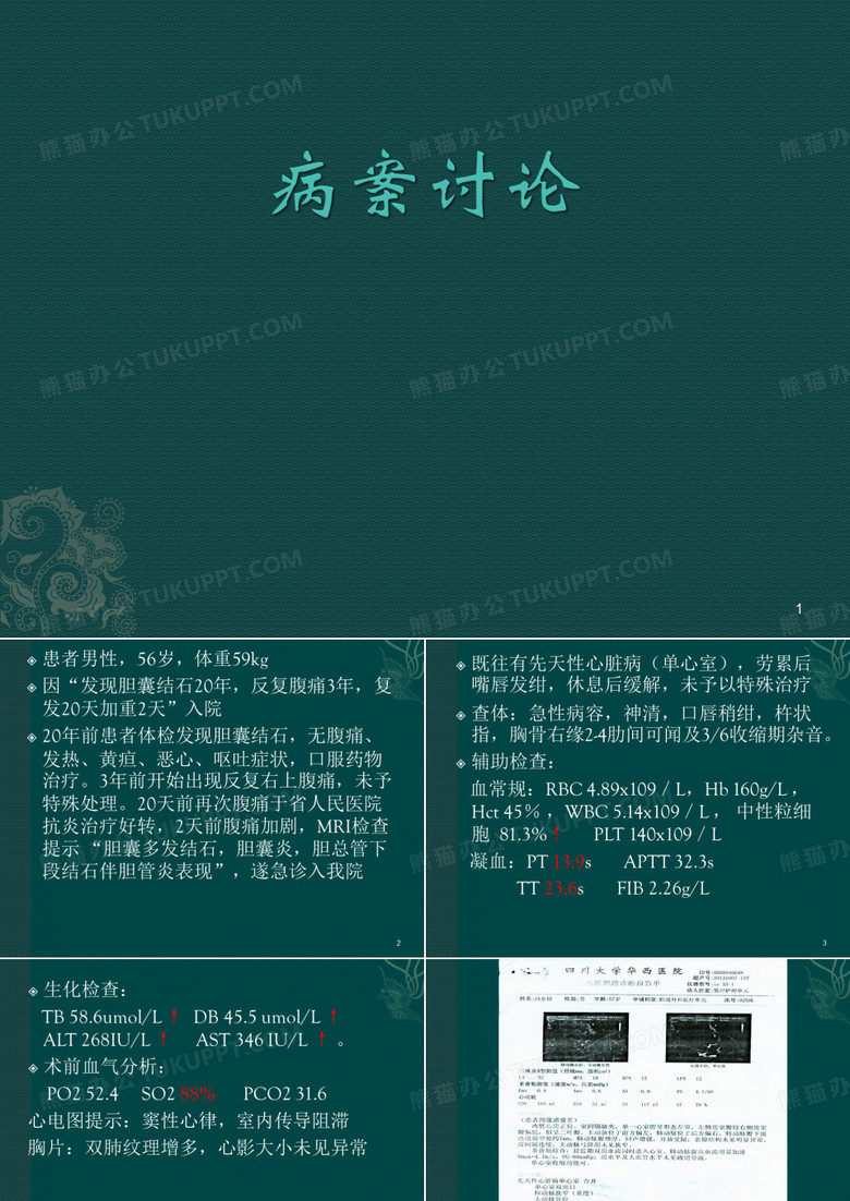 病案讨论单心室PPT模板下载 编号qpmxrgva 熊猫办公