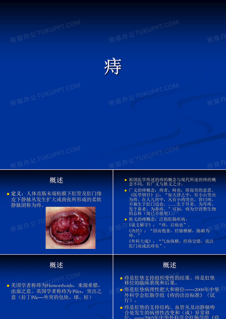 中医肛肠 痔PPT模板下载 编号qpmdwzem 熊猫办公