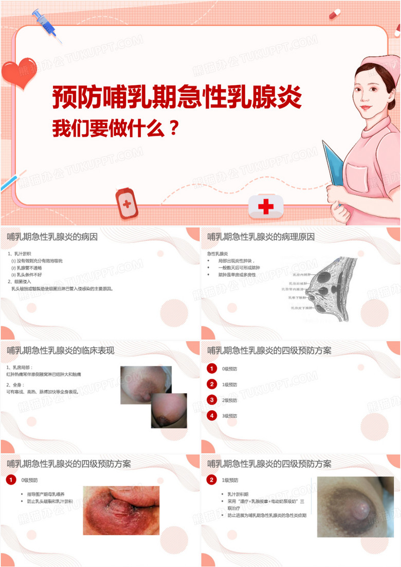 预防哺乳期急性乳腺炎措施科普PPT模板下载 熊猫办公