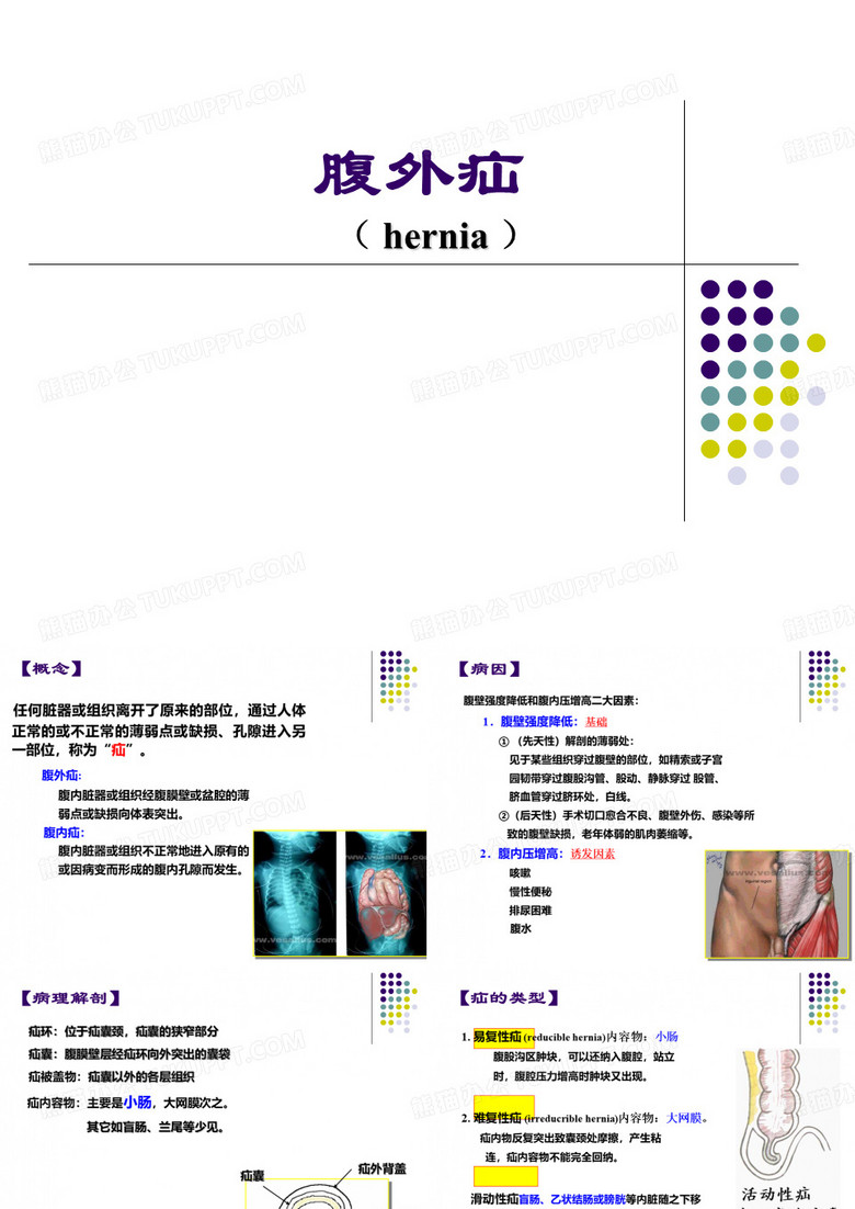 01腹外疝PPT模板下载 编号qrzevnkg 熊猫办公