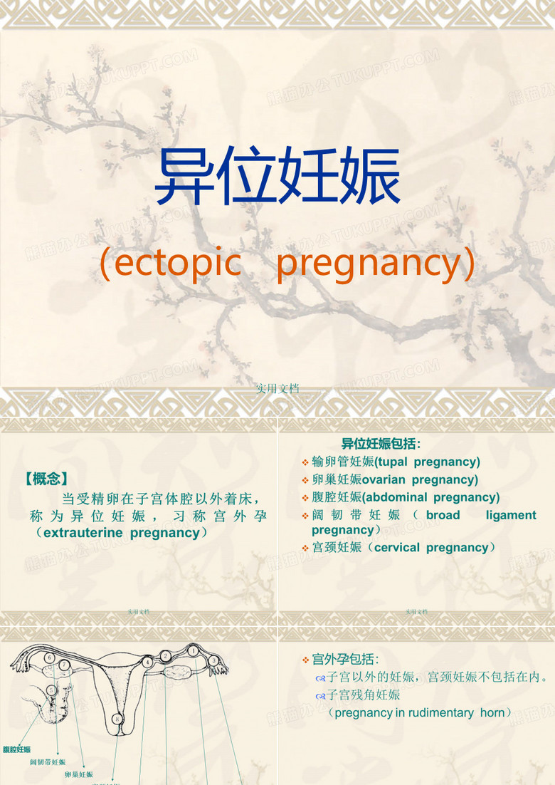 异位妊娠 PPT模板下载 编号lxedjmej 熊猫办公