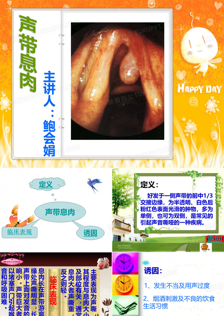 声带息肉PPT模板下载 编号lkeojzdo 熊猫办公