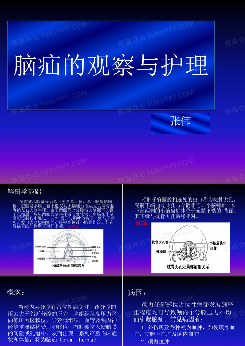 脑疝的观察与护理PPT模板下载 编号qzeaprnk 熊猫办公