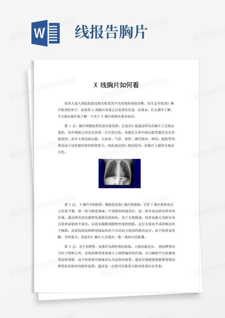 x线胸片如何看Word模板下载 编号lngxdekz 熊猫办公