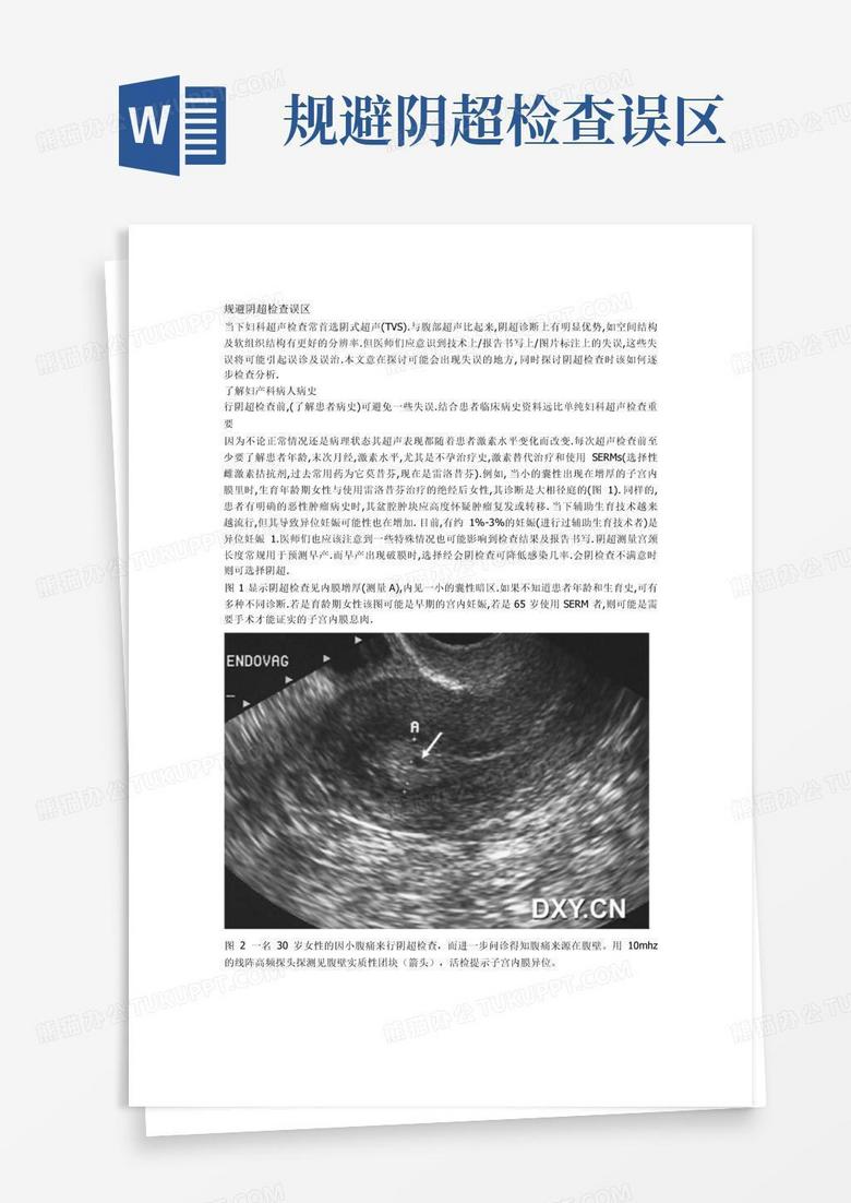 规避阴超检查误区Word模板下载 编号lzmjnkpo 熊猫办公