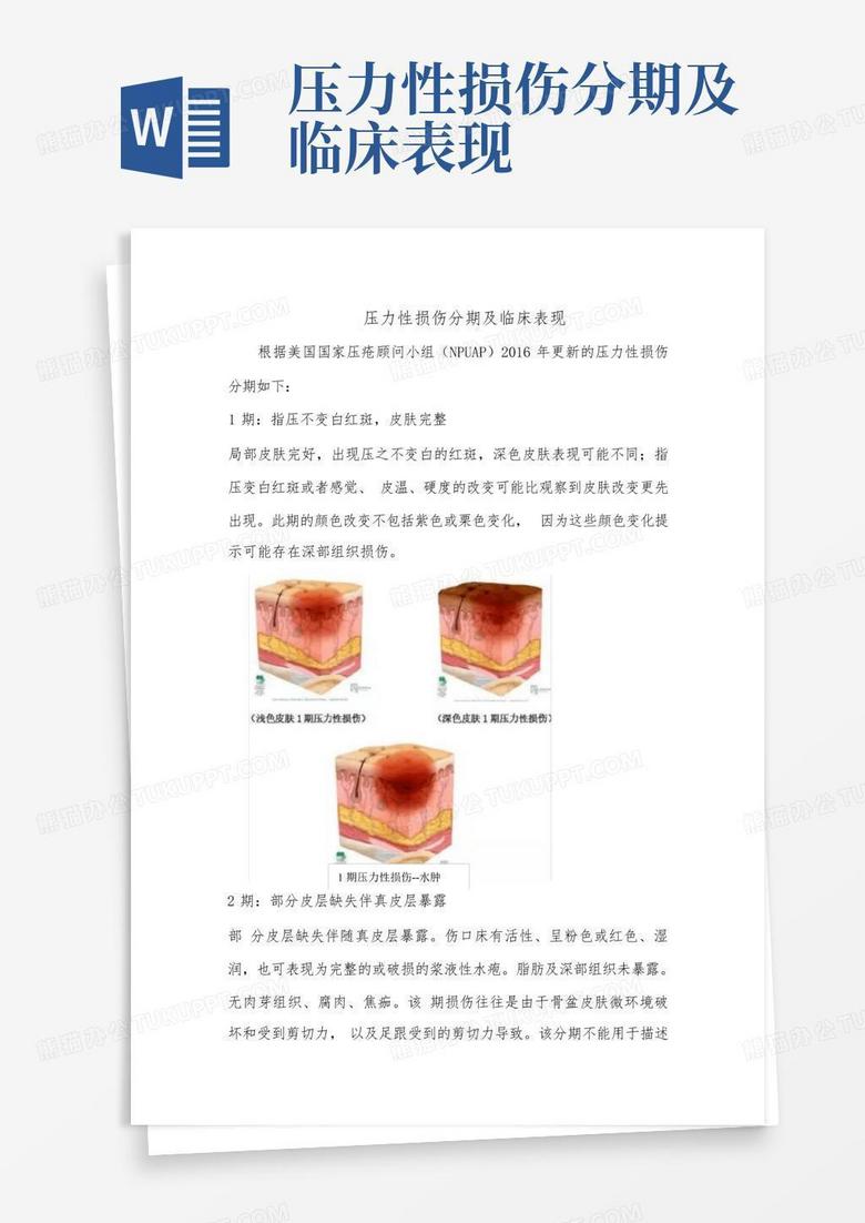 压力性损伤分期及临床表现Word模板下载 编号qyjwpddb 熊猫办公