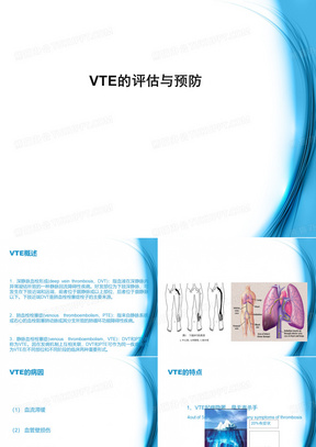 vte预防PPT模板_vte预防PPT模板下载_熊猫办公
