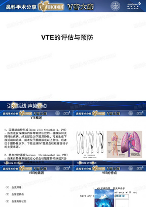 vte预防PPT模板_vte预防PPT模板下载_熊猫办公
