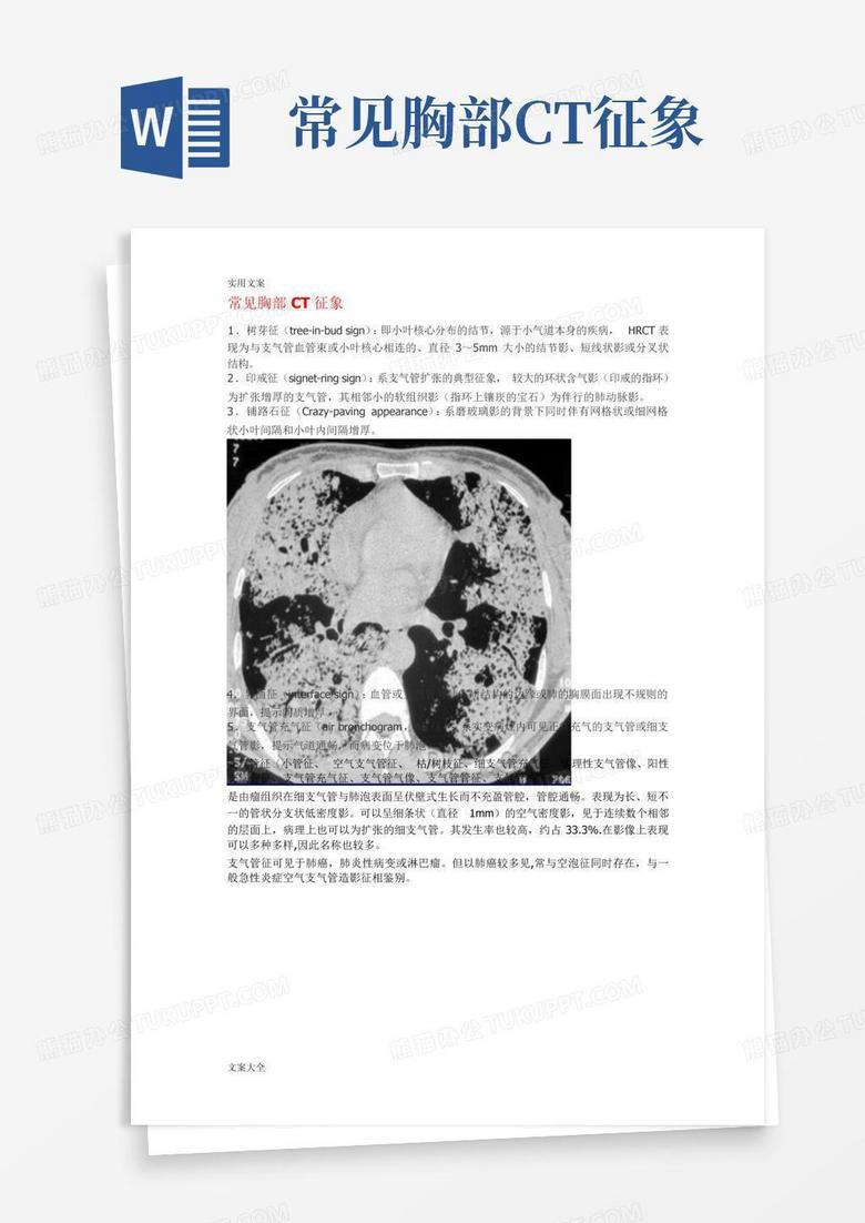 常见胸部ct征象Word模板下载_编号lyjnbodv_熊猫办公